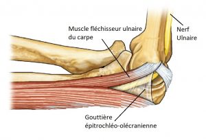 Compression du nerf ulnaire au coude – Centre Membre Supérieur Armoricain