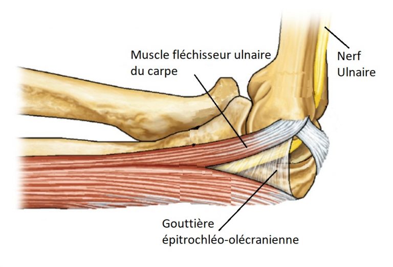 Compression du nerf ulnaire au coude – Centre Membre Supérieur Armoricain
